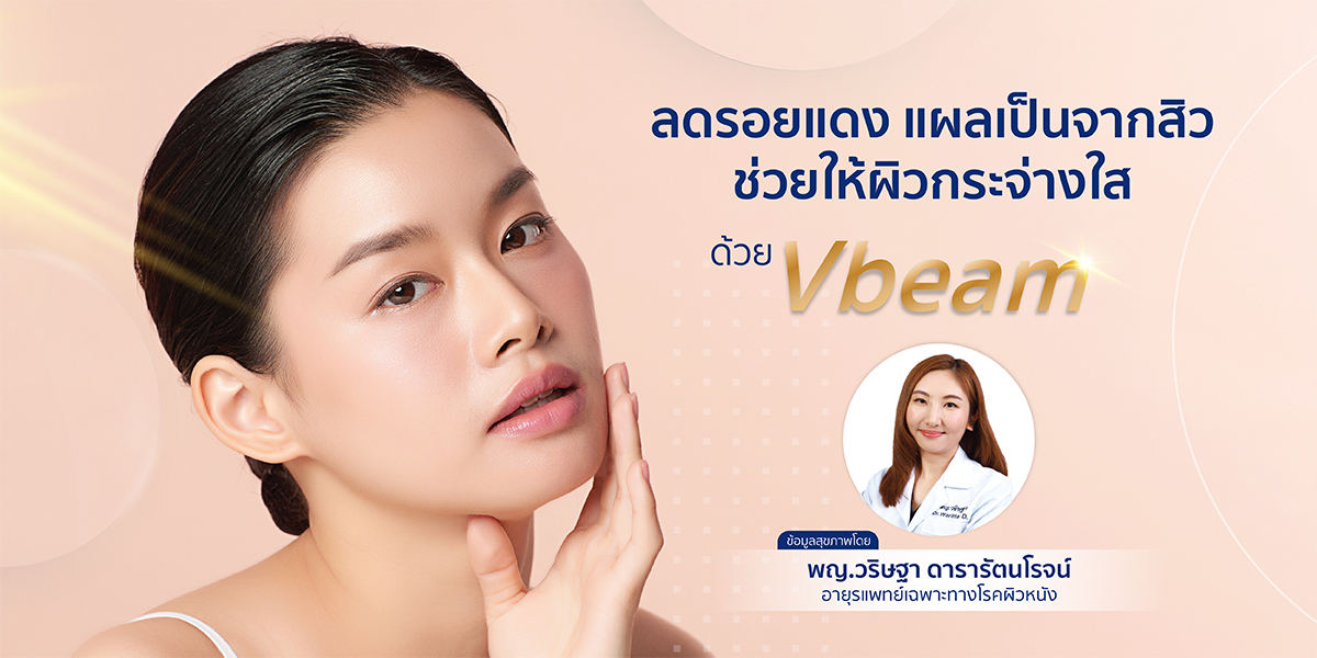 ลดรอยแดง แผลเป็นจากสิว ช่วยให้ผิวกระจ่างใสด้วย วีบีม (Vbeam) | โรงพยาบาลกรุงเทพภูเก็ต